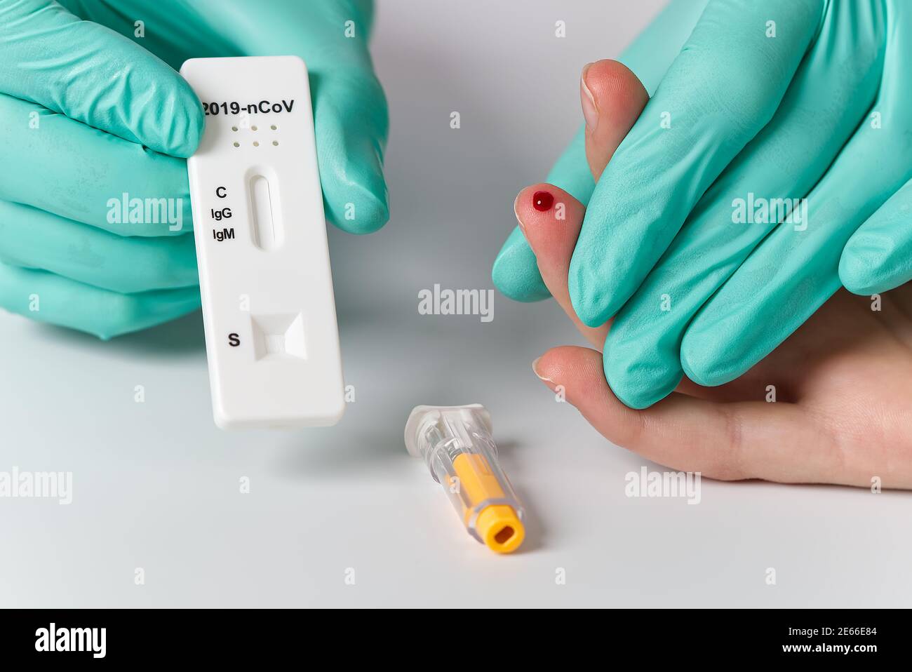 Positive COVID-19 test and laboratory sample of blood testing for ...