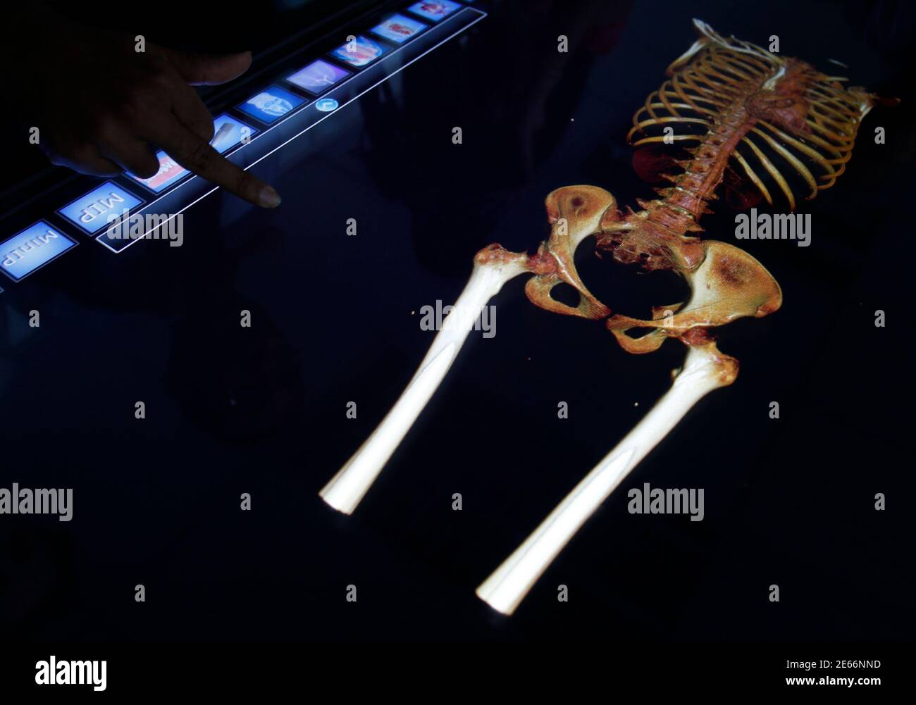 Autopsy table in a mortuary hi-res stock photography and images - Alamy