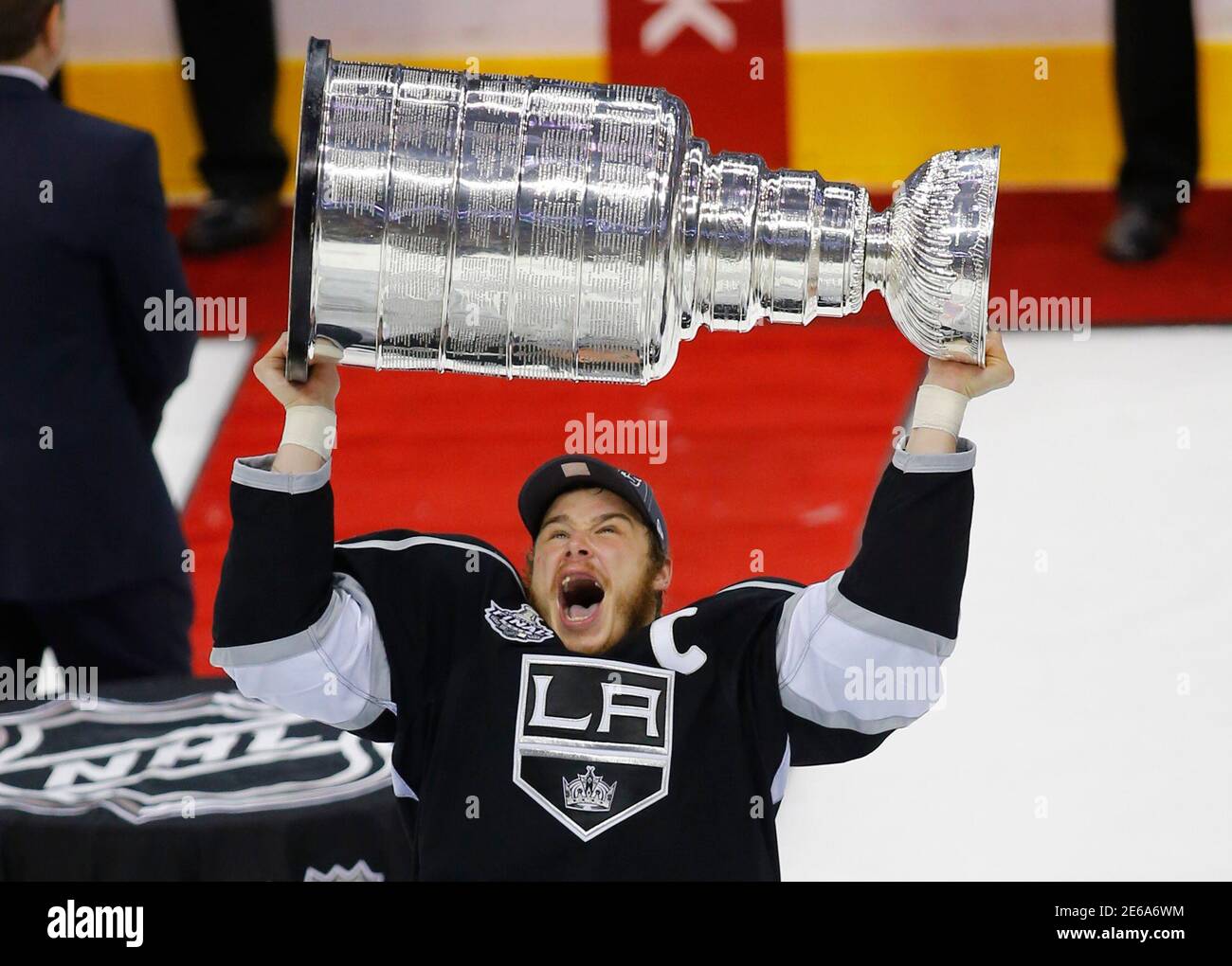 Dustin Brown Teeth