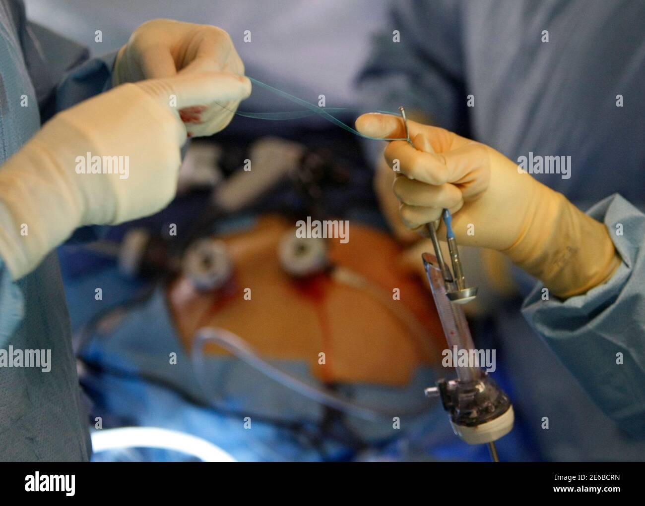 Laparoscopic procedures hi-res stock photography and images - Alamy