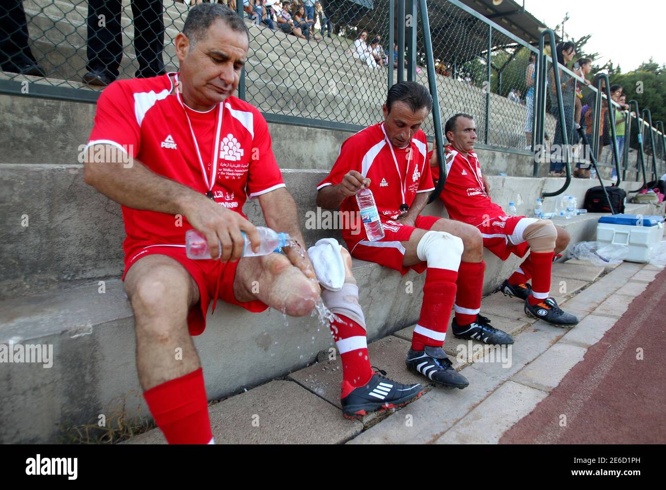 Landmine survivors hi-res stock photography and images - Alamy