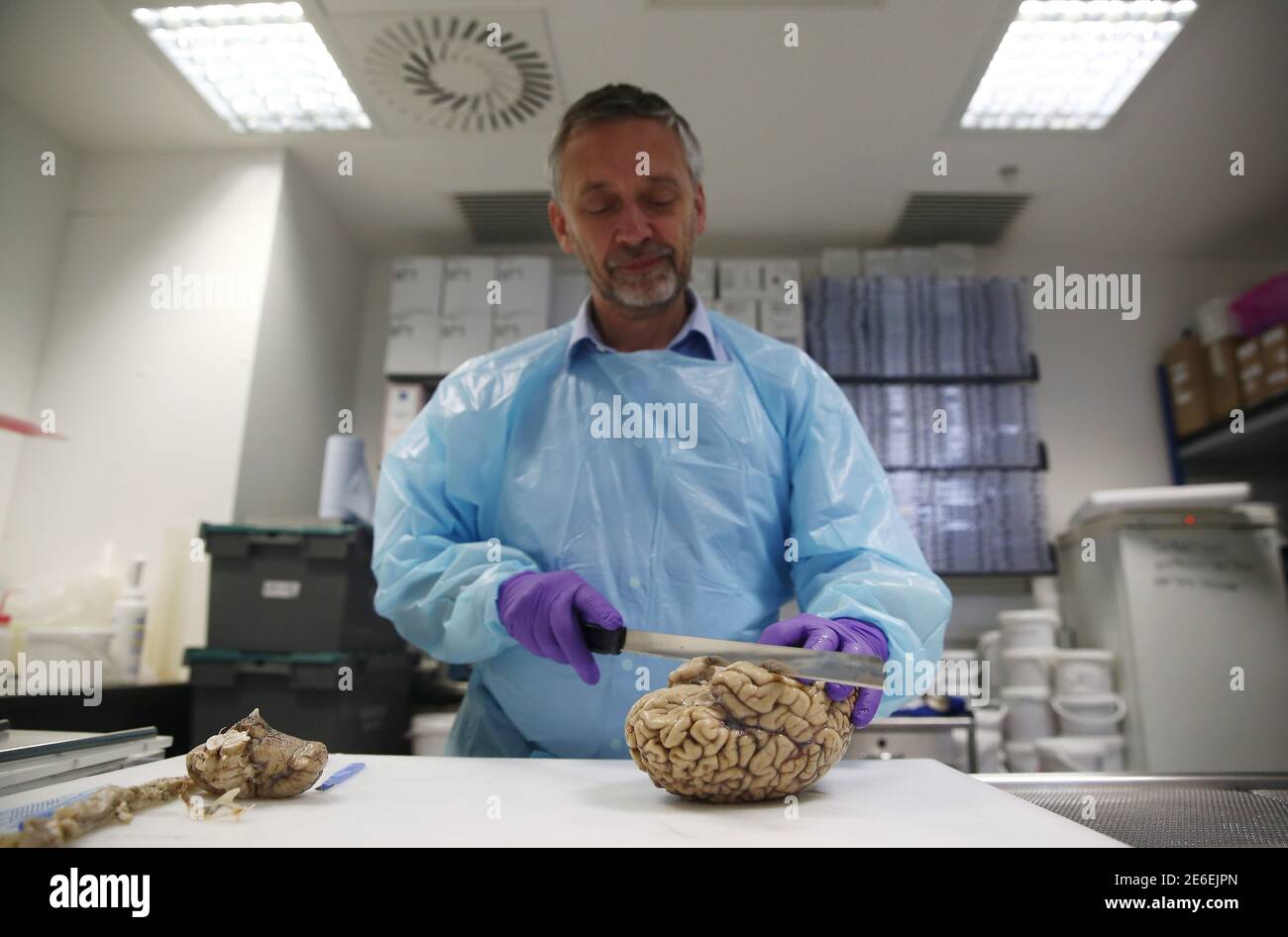 Human tissue bank hi-res stock photography and images - Alamy