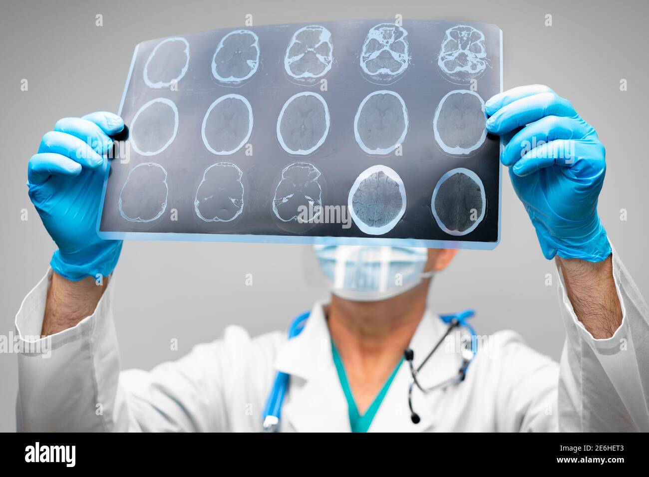Hands of a doctor holding head mri scan Stock Photo - Alamy