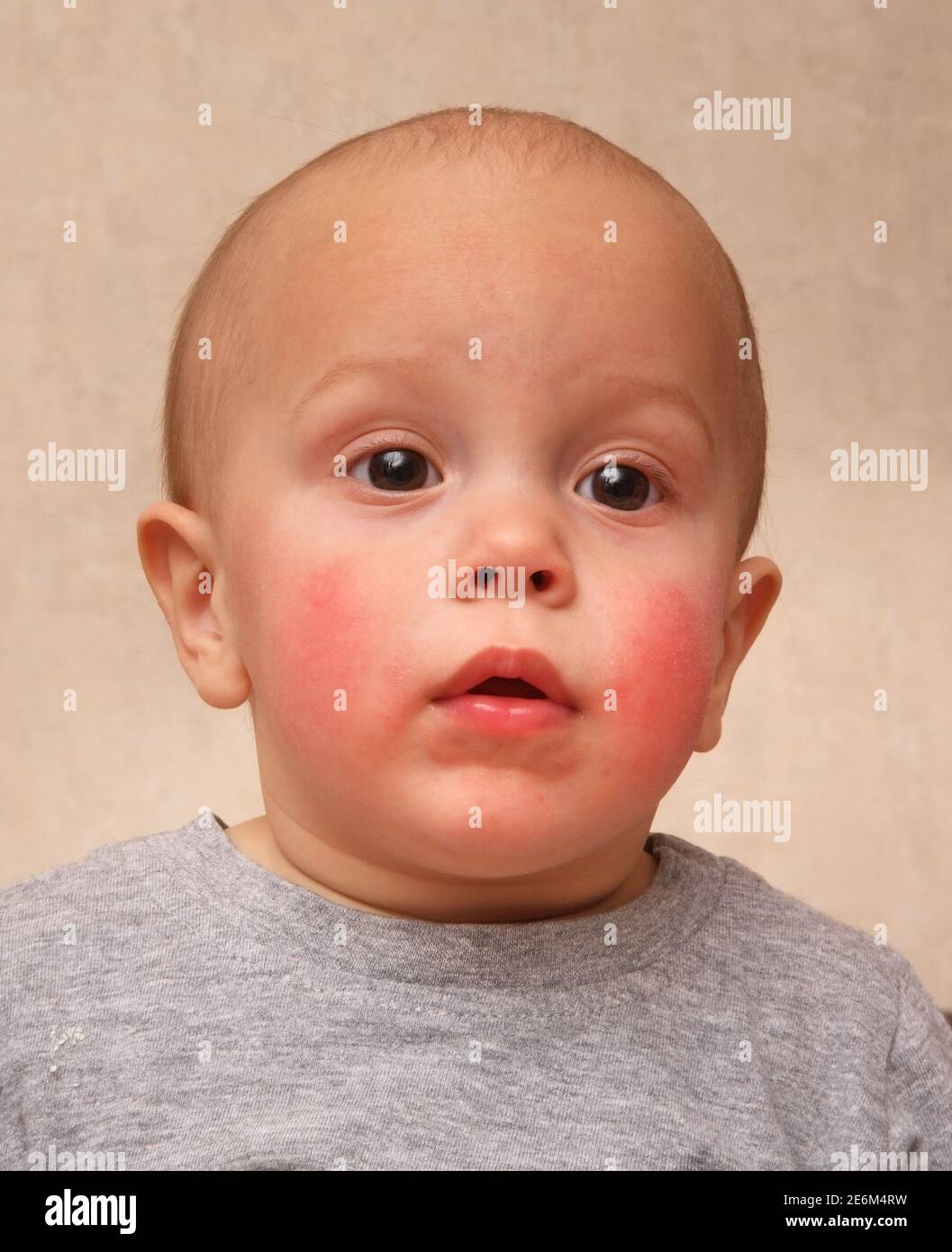 Pink Cheeks High Resolution Stock Photography and Images - Alamy