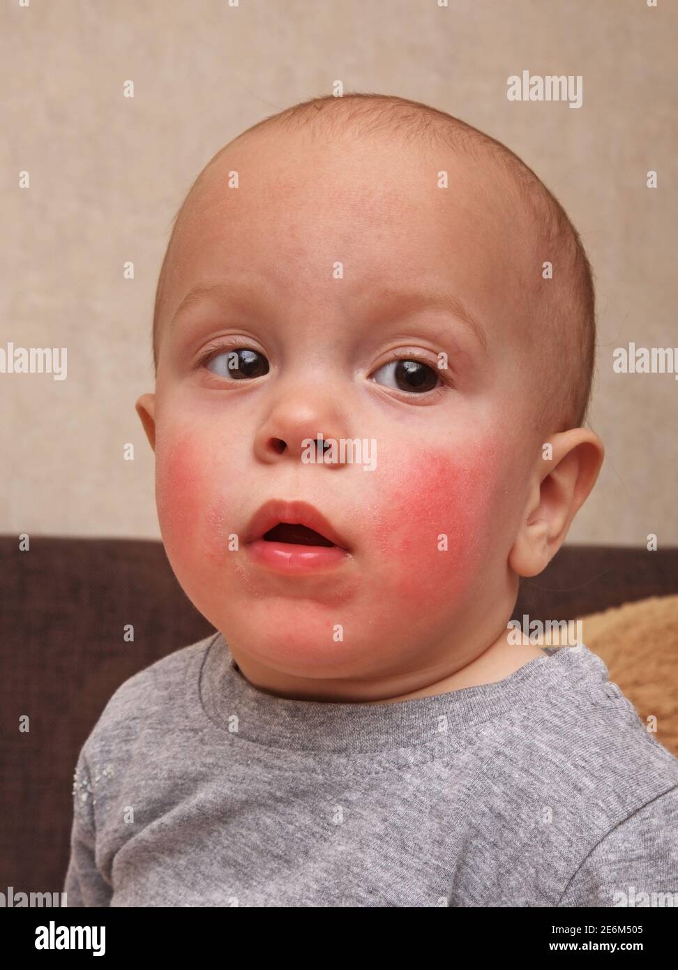 Small boy with pink cheeks Stock Photo - Alamy