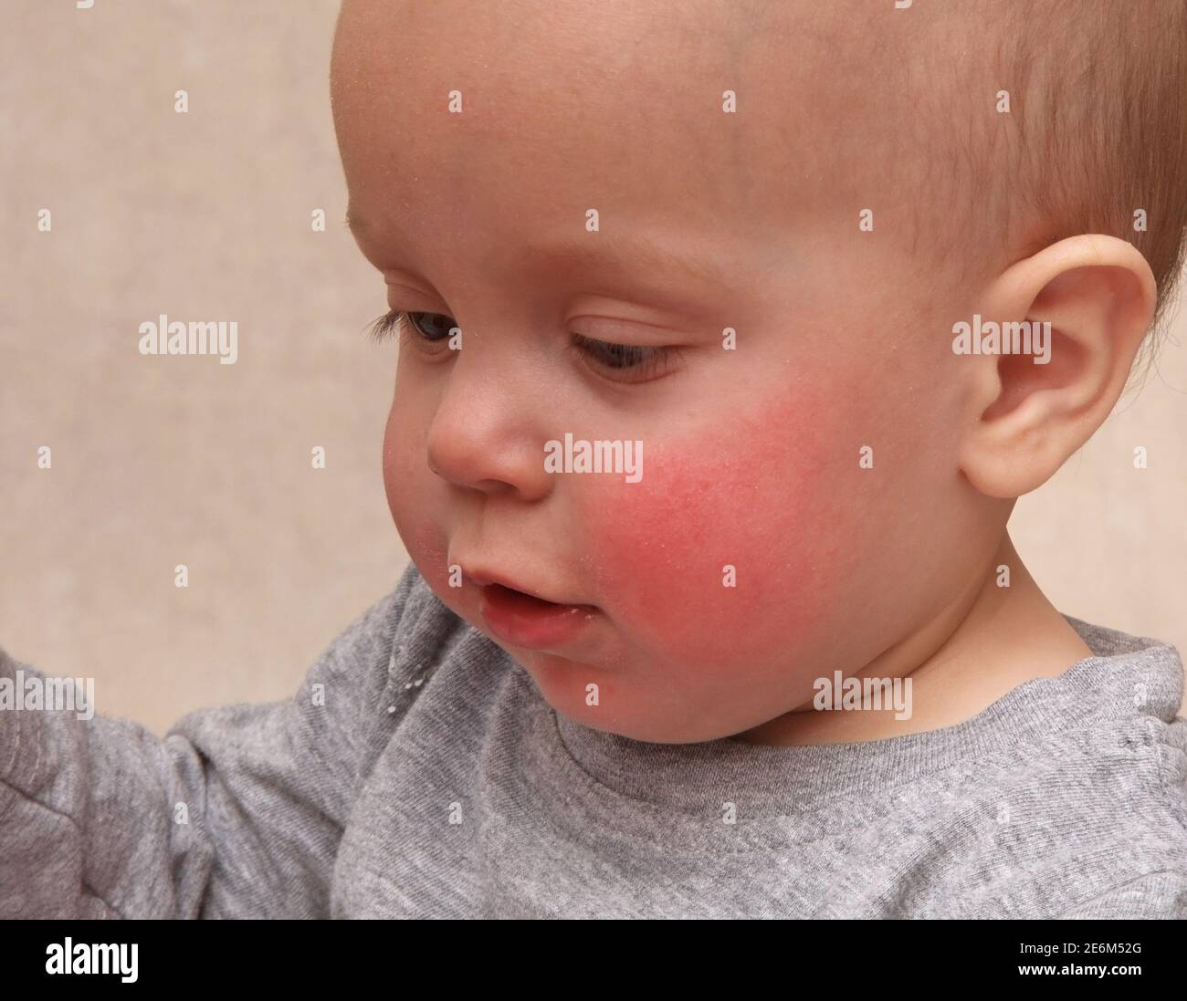 Small boy with pink cheeks Stock Photo - Alamy