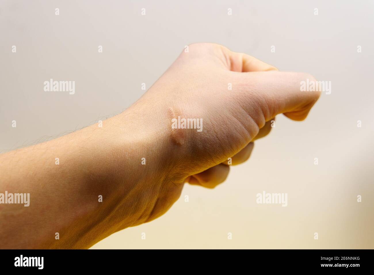 traces of a cut on the hand, a scar on the hand close-up macro ...