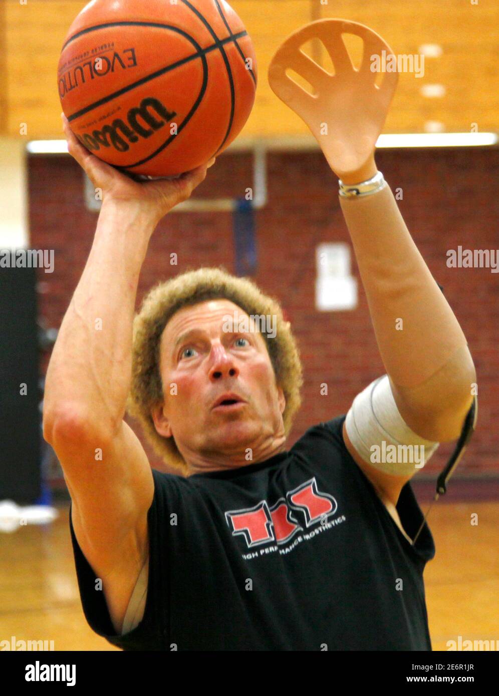 Multiple amputee hi-res stock photography and images - Alamy