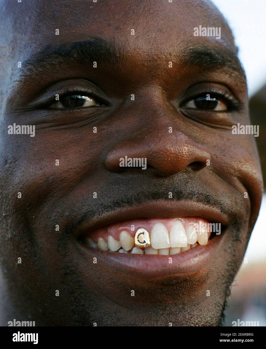 Gold tooth hi-res stock photography and images - Alamy