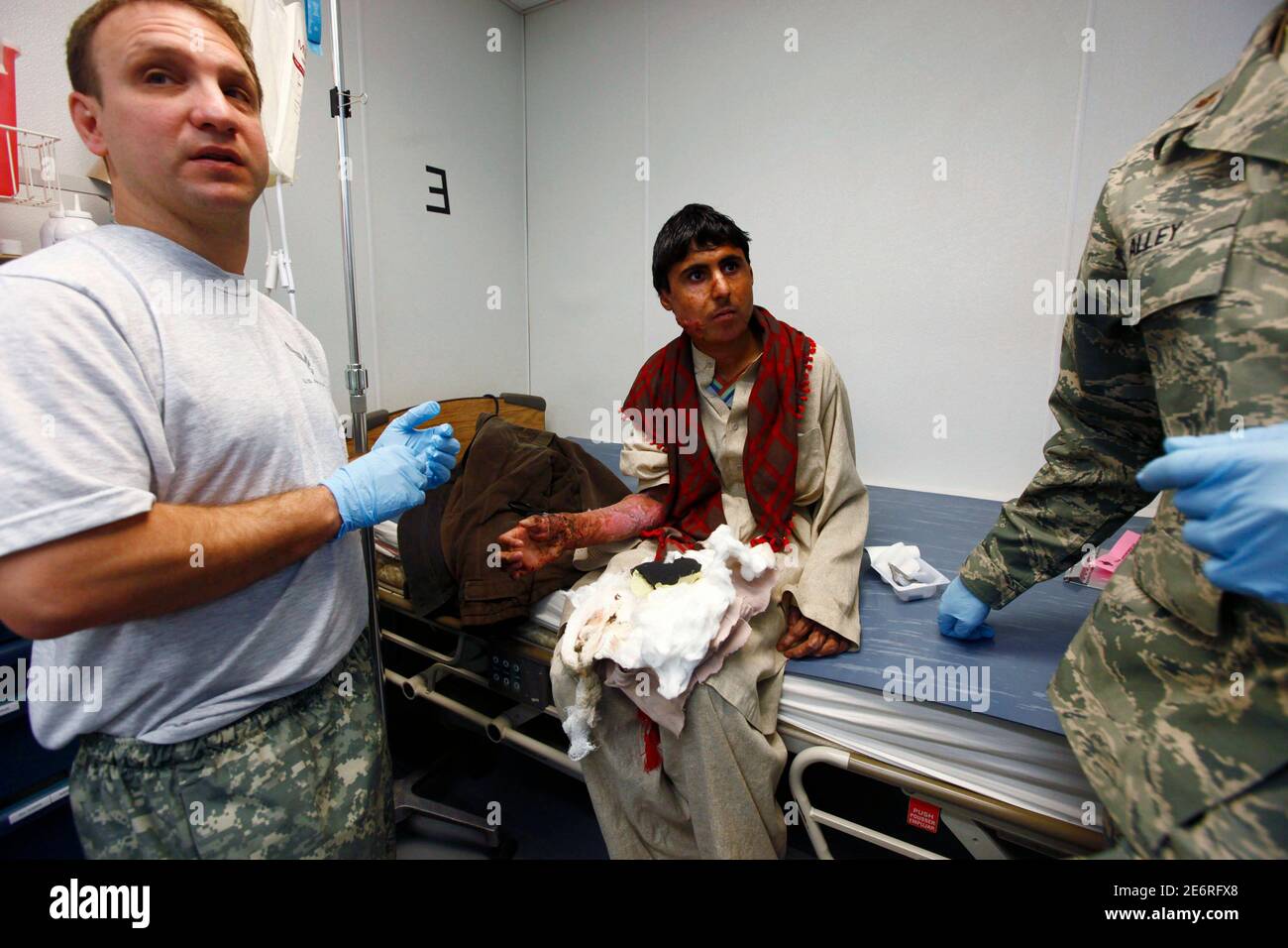 Burn injuries face hi-res stock photography and images - Alamy