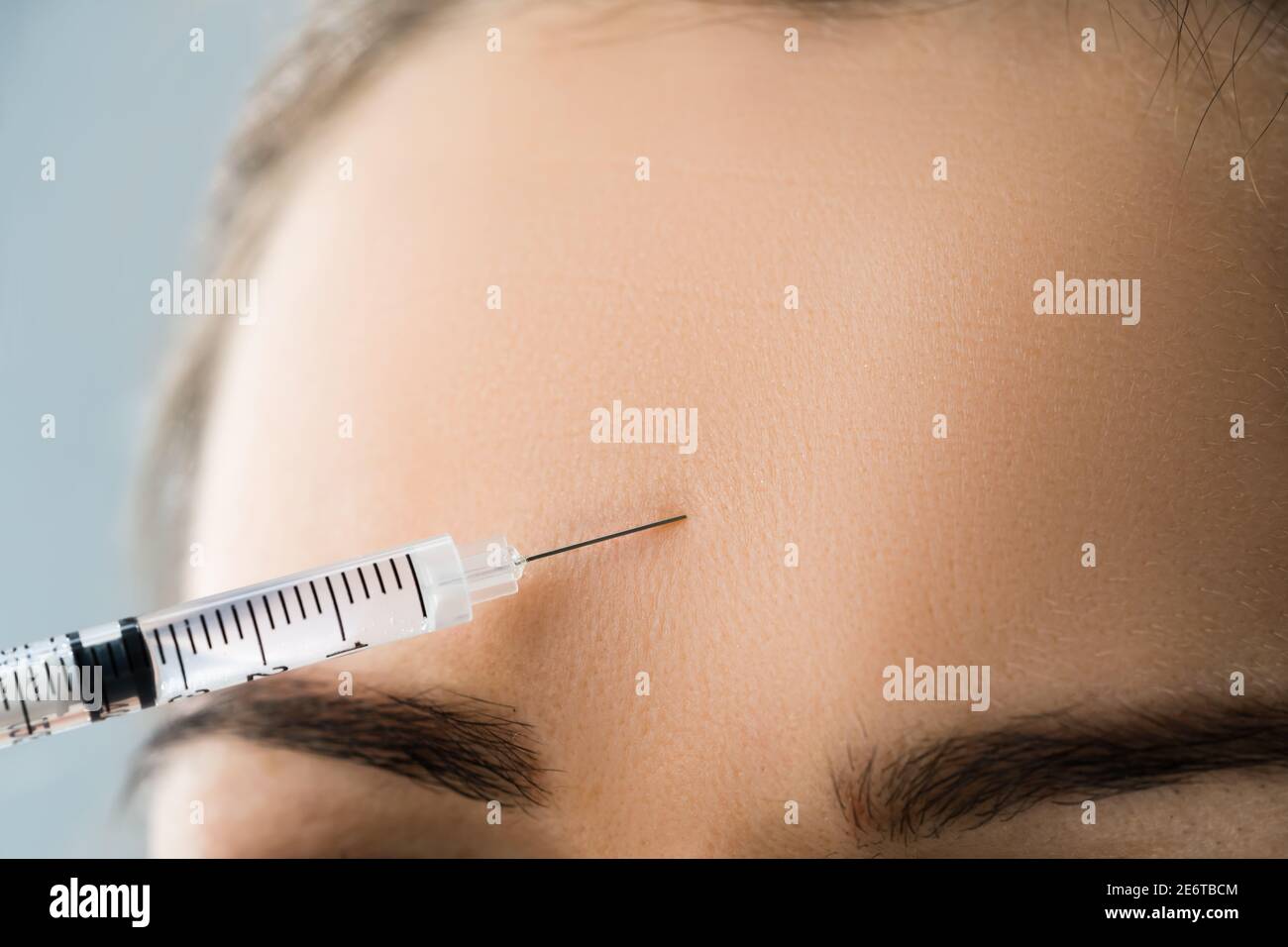 Collagen Forehead Face Lift Injection Beauty Treatment Stock Photo - Alamy