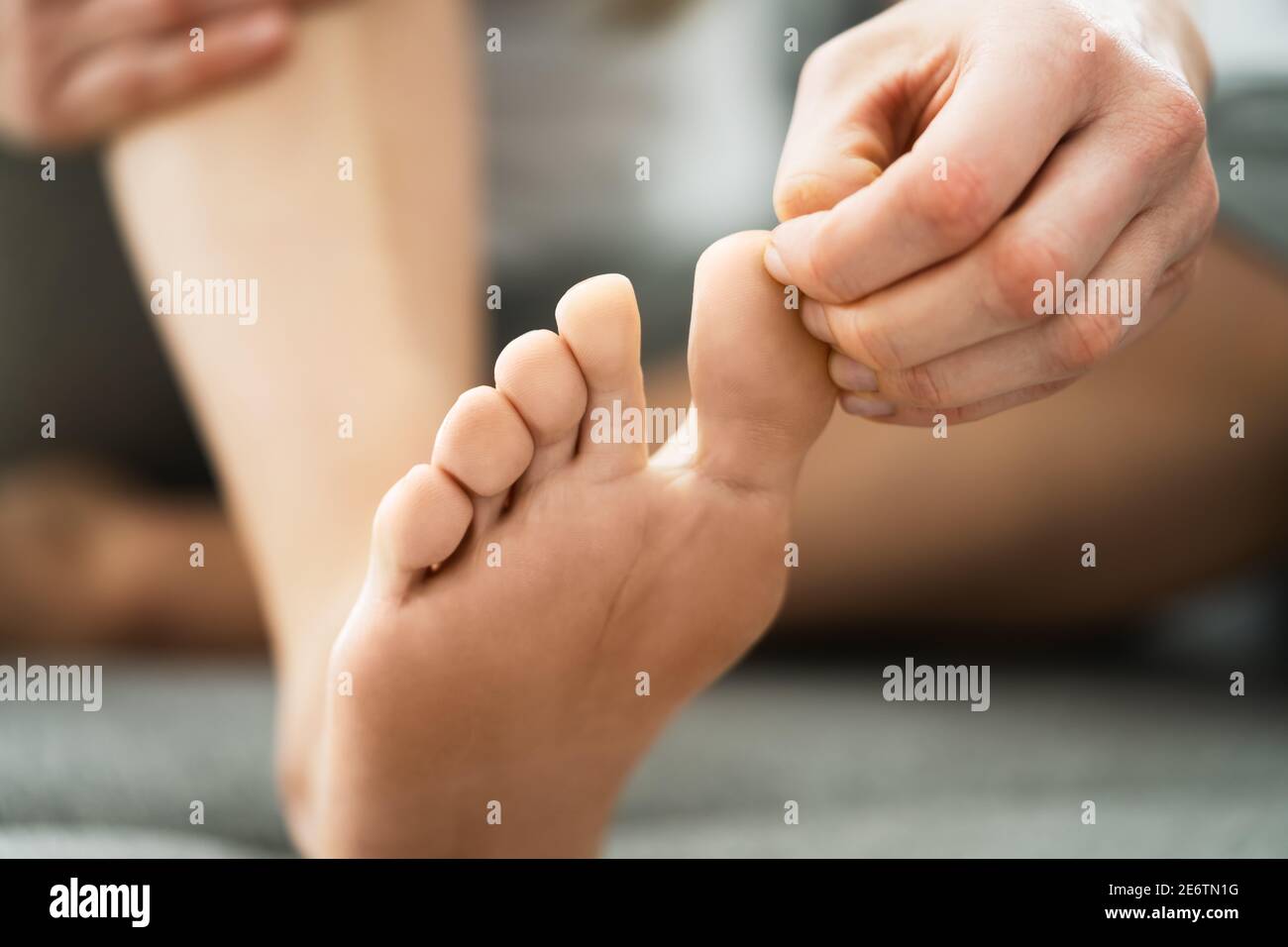 Hand Scratching Sore Foot With Fungus Rash Infection Stock Photo - Alamy