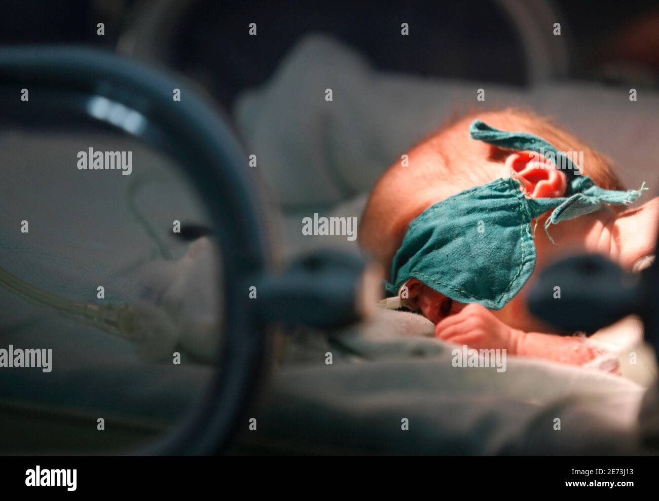 Neonatal phototherapy hi-res stock photography and images - Alamy