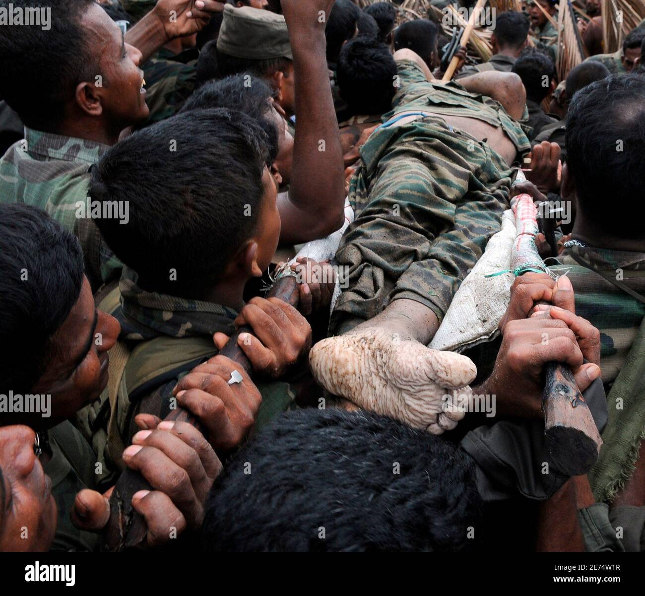 Top of head taken off hi-res stock photography and images - Alamy