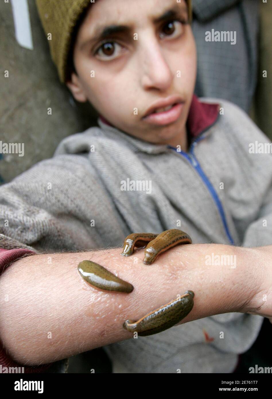 Indian leech hi-res stock photography and images - Alamy