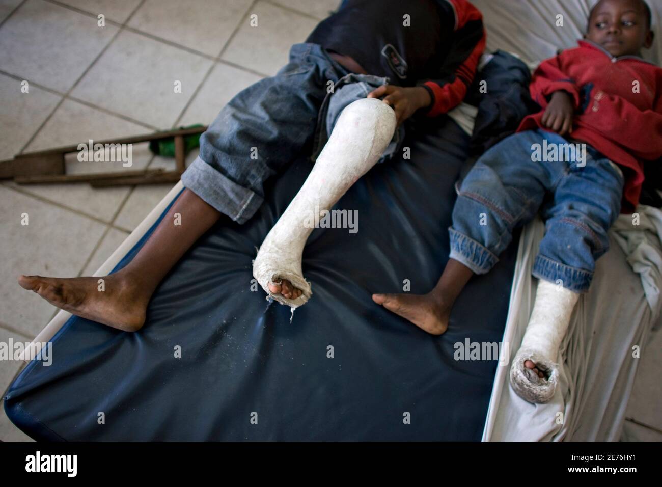 Boy leg in plaster cast hi-res stock photography and images - Alamy