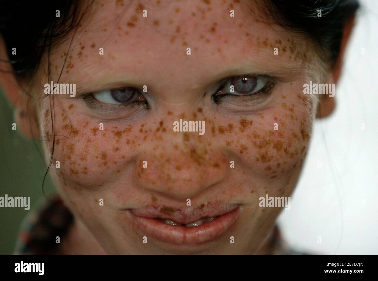 Indian blind girl hi-res stock photography and images - Alamy