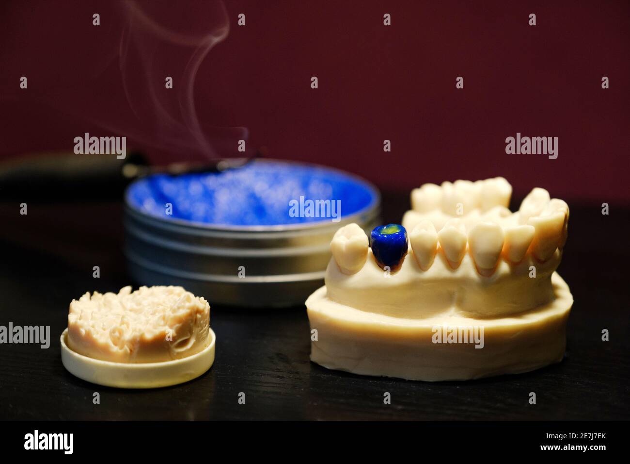 Dental technician work. Prosthesis production. Dental still life. Model ...