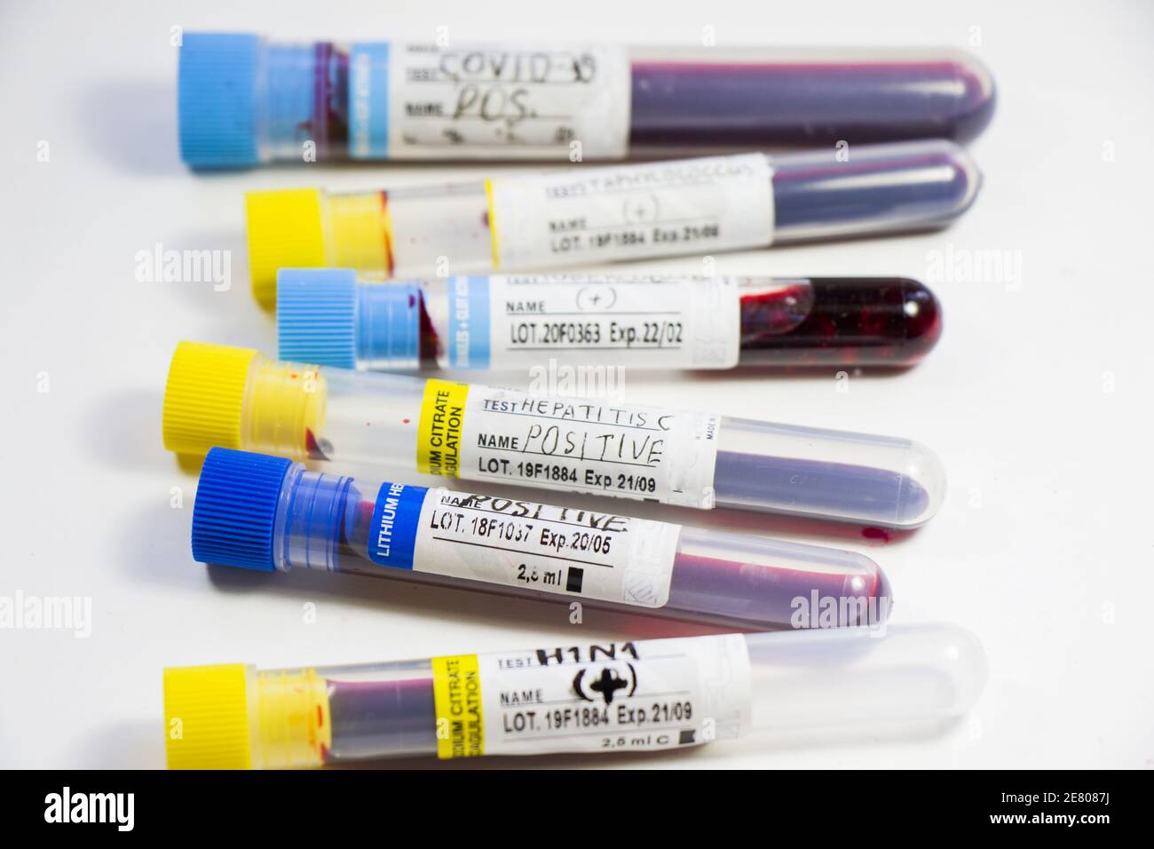 Isolated shot of some blood test tubes with positive results on white ...