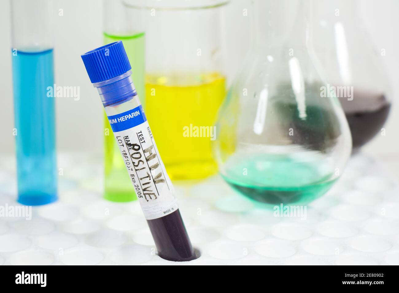 Isolated shot of a blood test sample with positive result on colorful ...
