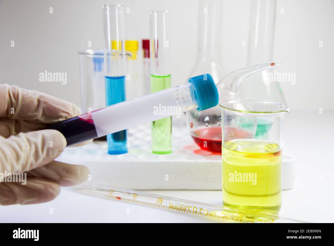 Isolated shot of a blood test sample in a doctor hand on colorful glass ...
