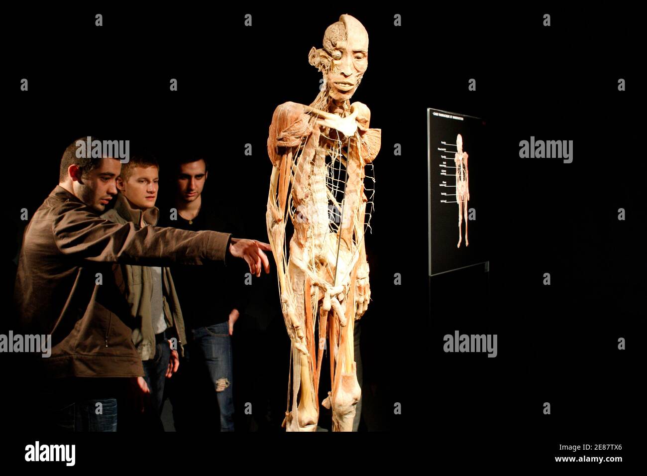 The german professor gunther von hagens hi-res stock photography and ...
