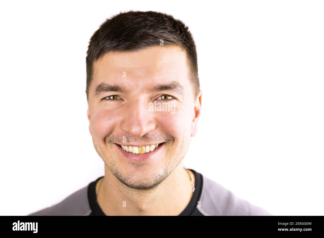 Yellow damaged tooth of a smiling Caucasian man in close-up. Focus on ...
