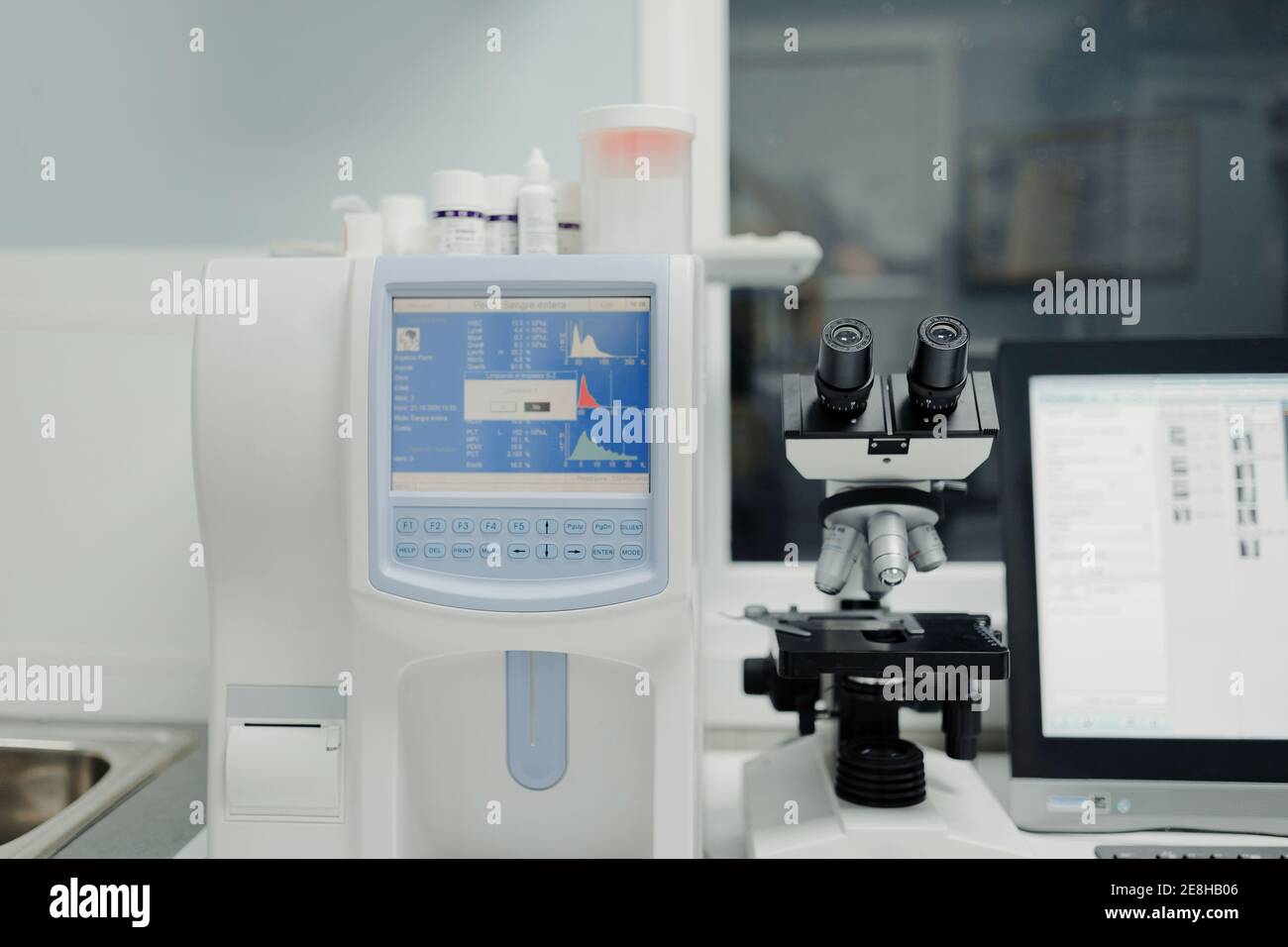 Hematology analyzer with graphs on monitor near microscope and desktop ...