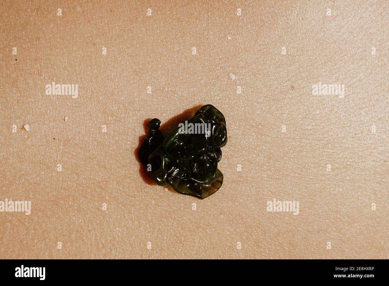 Bladder wrack woman hi-res stock photography and images - Alamy