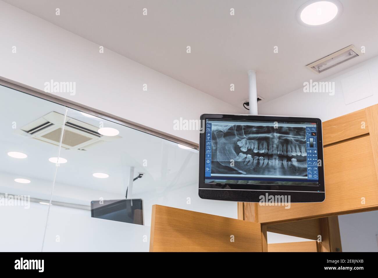 Screen with dental X-rays. Dental office Stock Photo - Alamy
