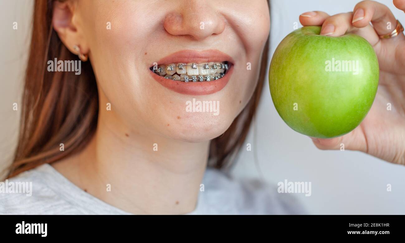 Green braces hi-res stock photography and images - Alamy