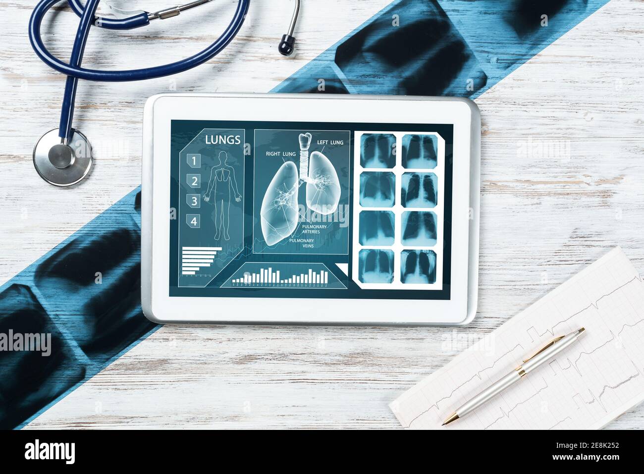 Medical diagnostics in modern hospital Stock Photo - Alamy