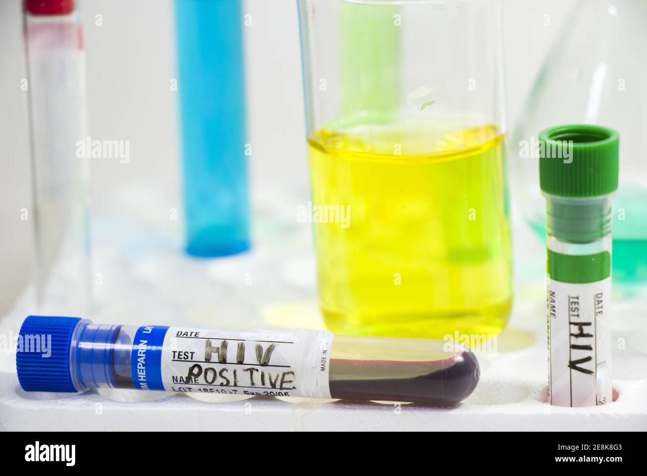 An isolated shot of a positive blood test tube and flasks with colorful ...