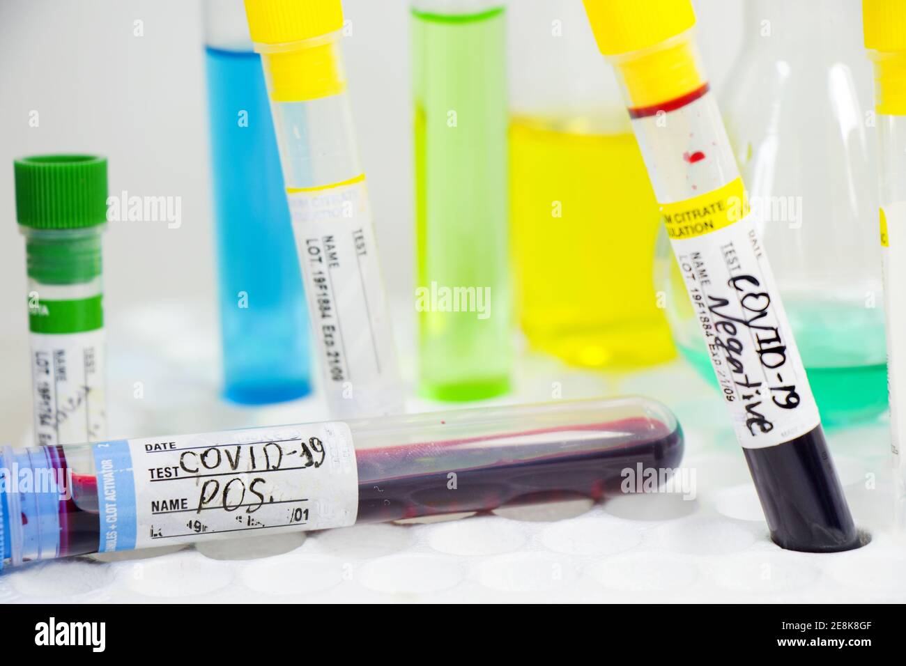 An isolated shot of blood test tubes with positive and negative results ...