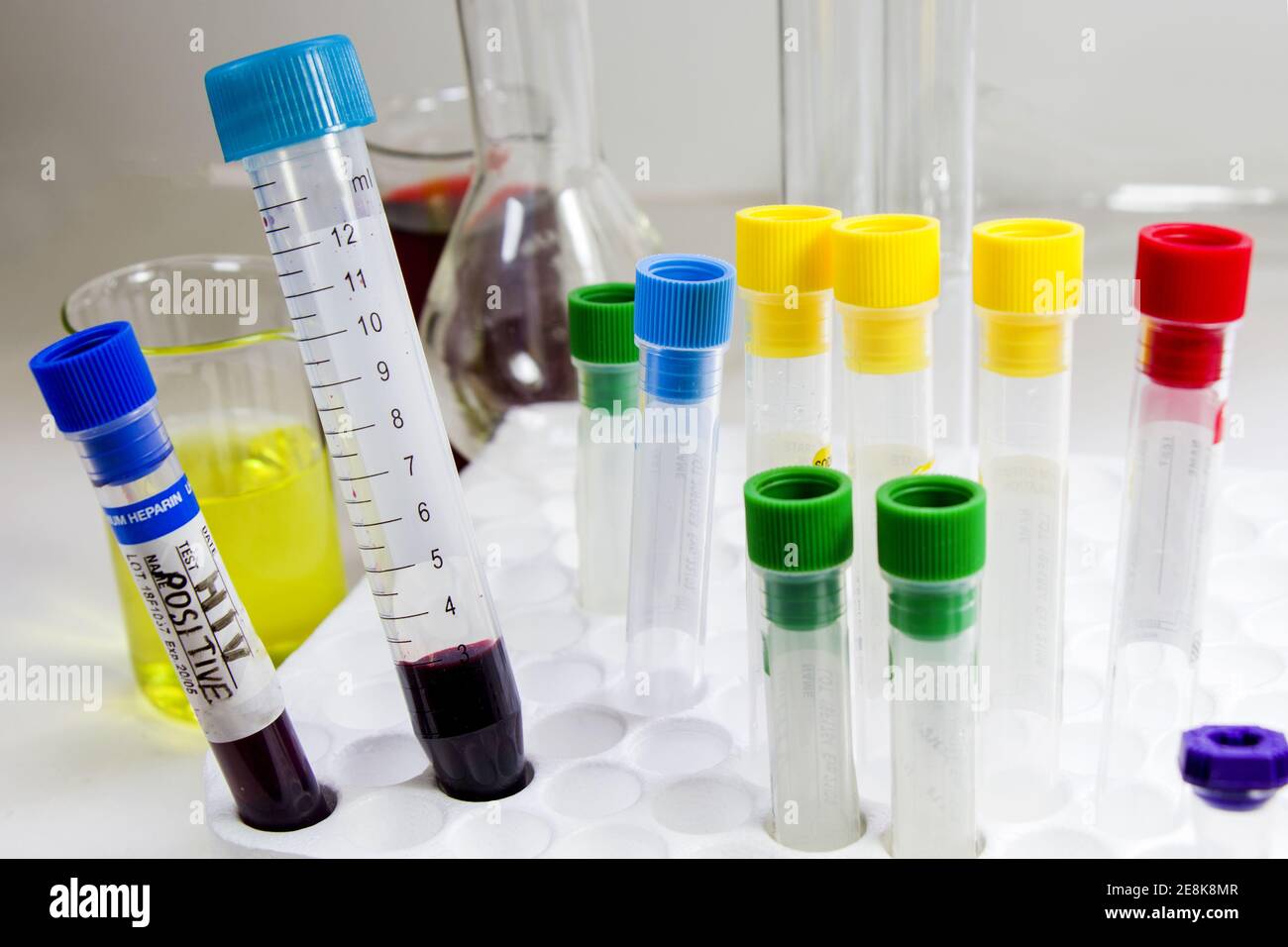A high angle shot of blood test tubes and glass flasks on white ...