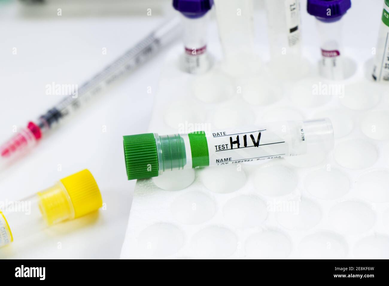 A high angle shot of empty blood test sample tube on white background ...