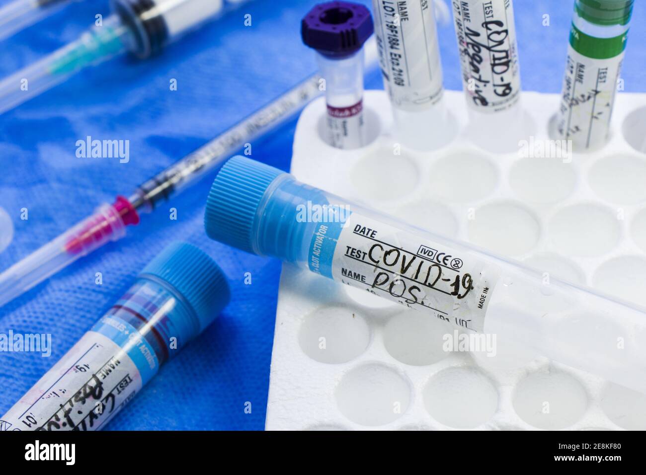 Empty yellow blood test tube hi-res stock photography and images - Alamy