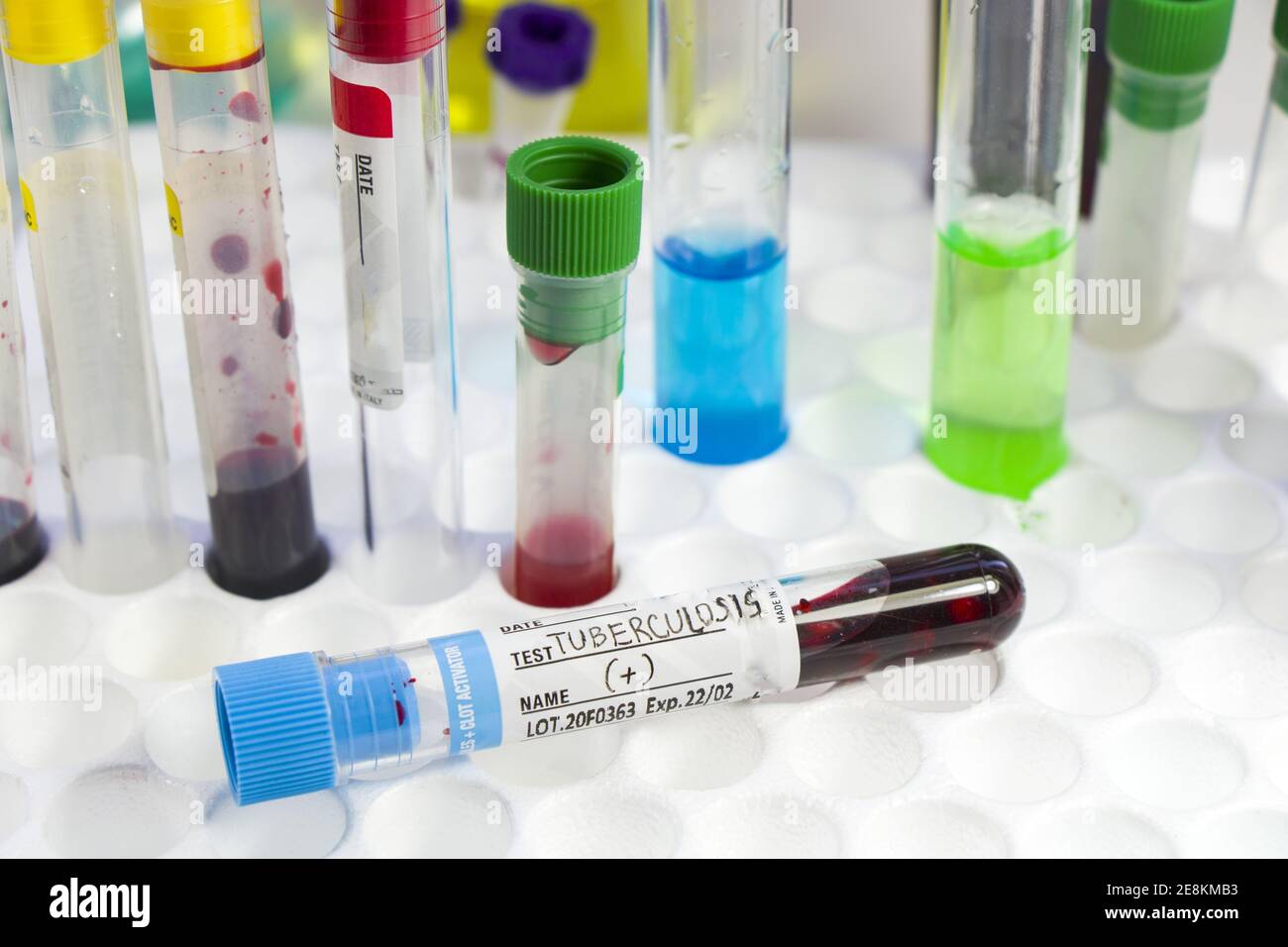 Tuberculosis clinic hi-res stock photography and images - Alamy