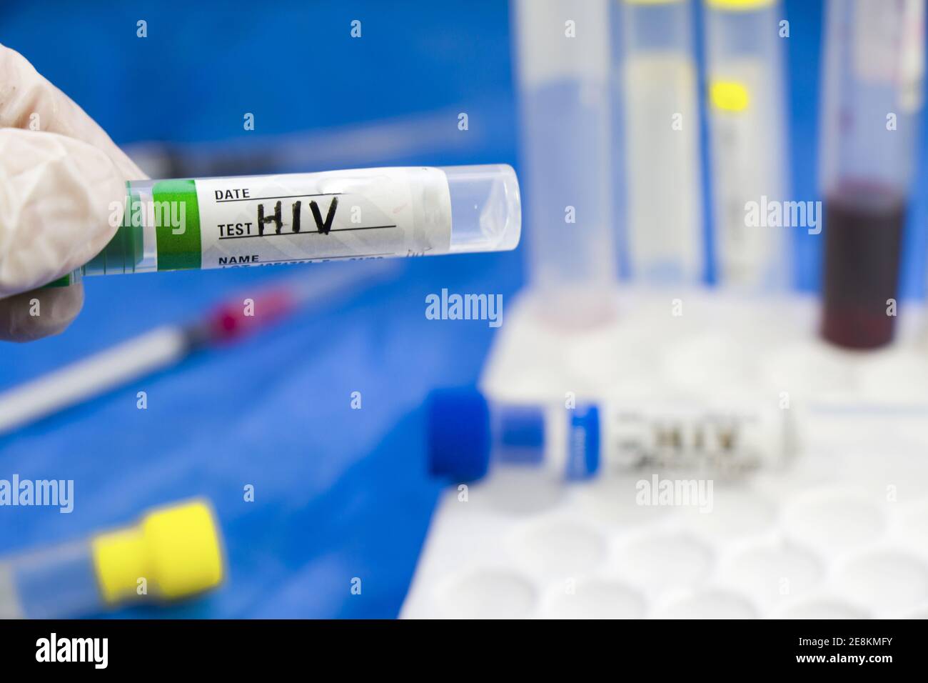 Empty yellow blood test tube hi-res stock photography and images - Alamy