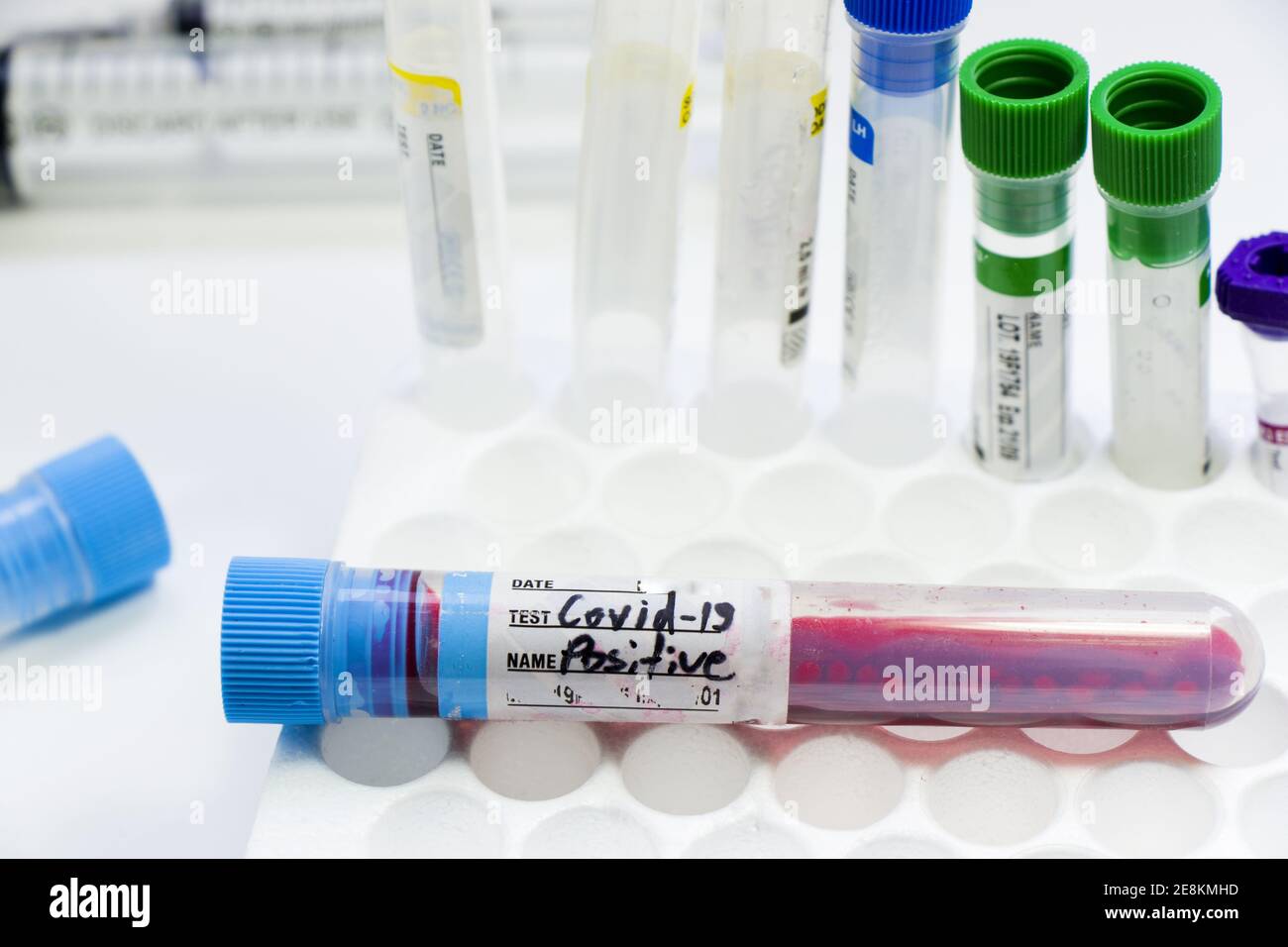Blood tube sticker hi-res stock photography and images - Alamy