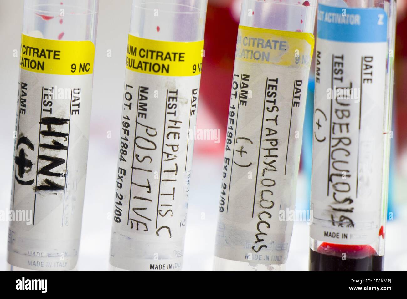 A closeup shot of blood test sample tubes with positive results Stock ...