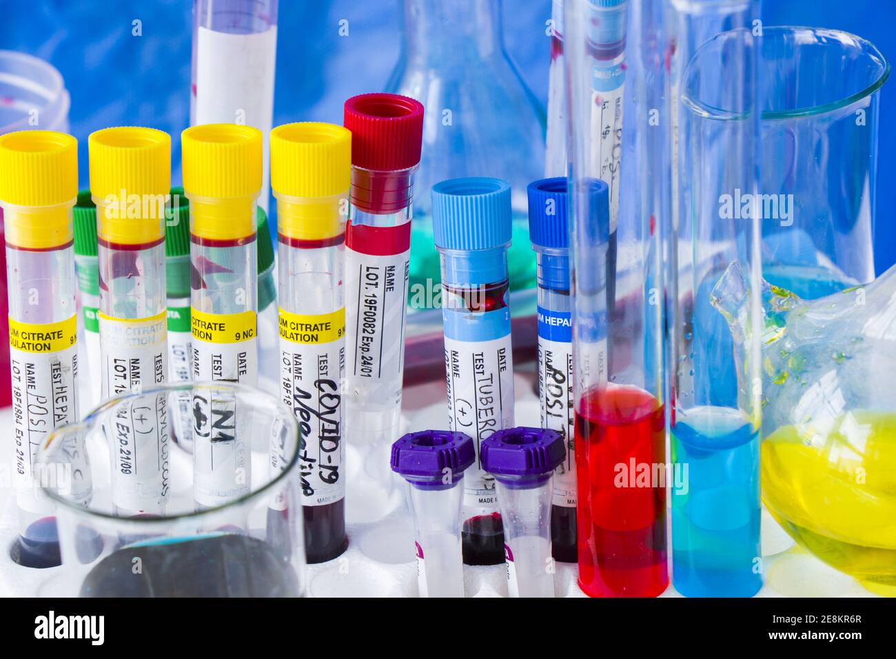 A closeup of colorful liquid chemical elements and viruses tests on the ...