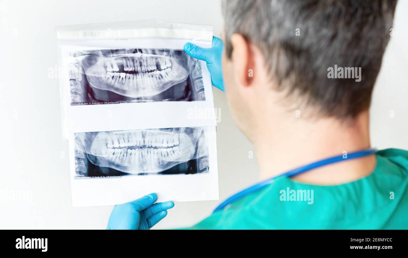 The dentist examines a panoramic X-ray image of the teeth of the upper ...