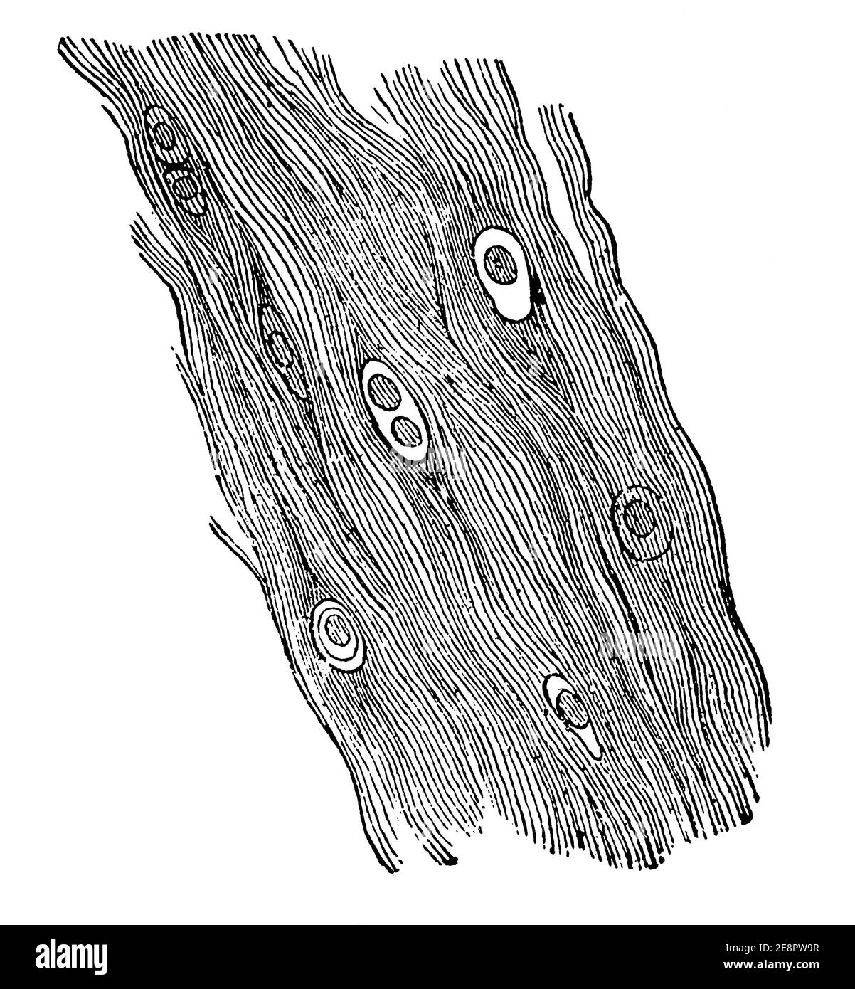 Fibrocartilage Drawing