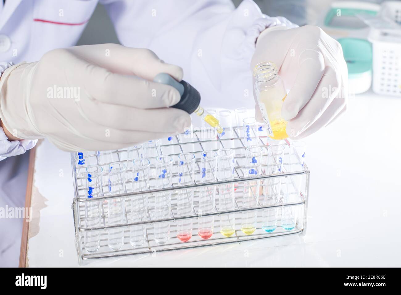 Close-up of test tubes arranged on a tray in medical laboratory ...