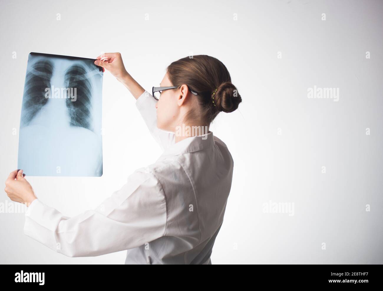 Doctor looking chest x-ray Stock Photo - Alamy