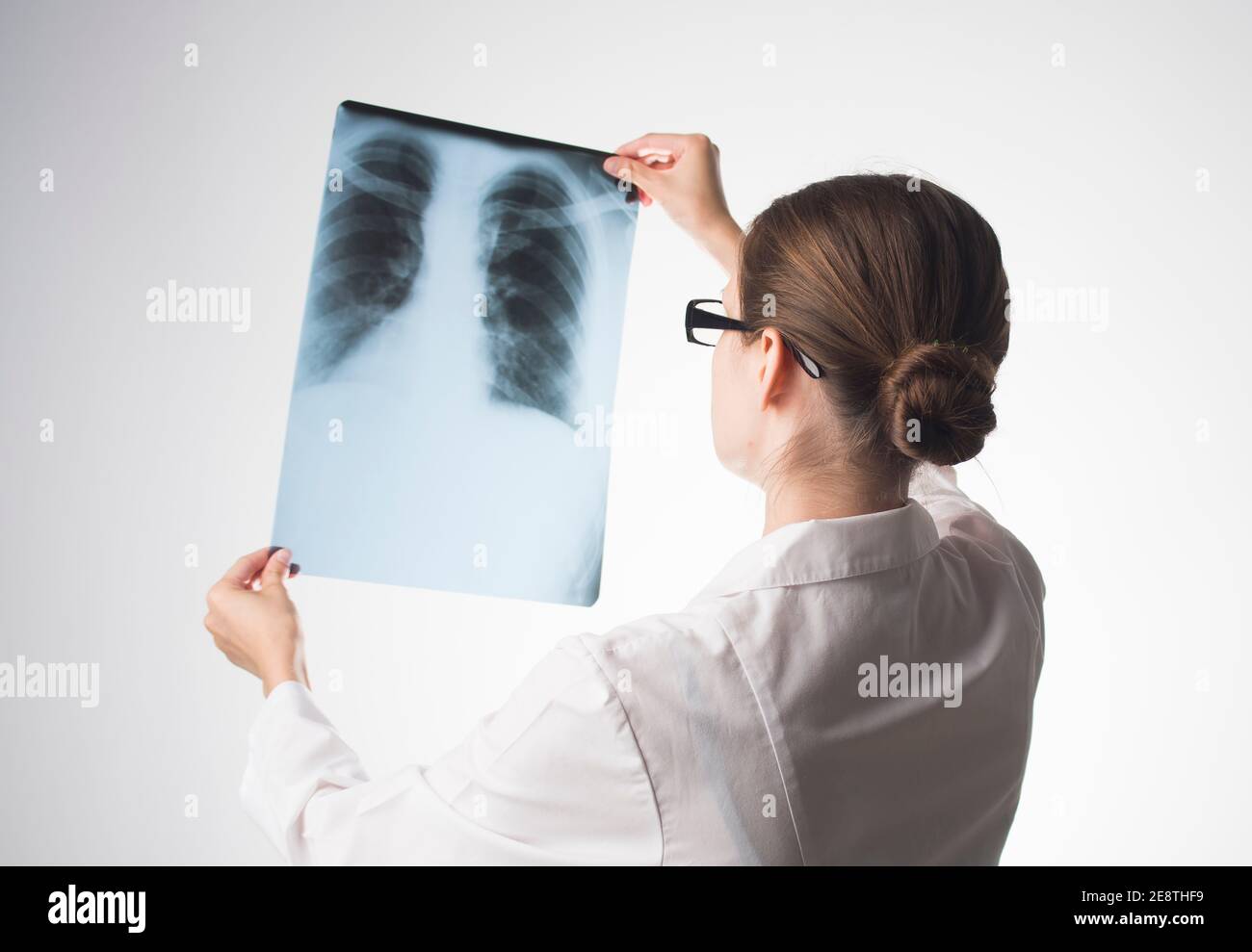 Doctor looking chest x-ray Stock Photo - Alamy