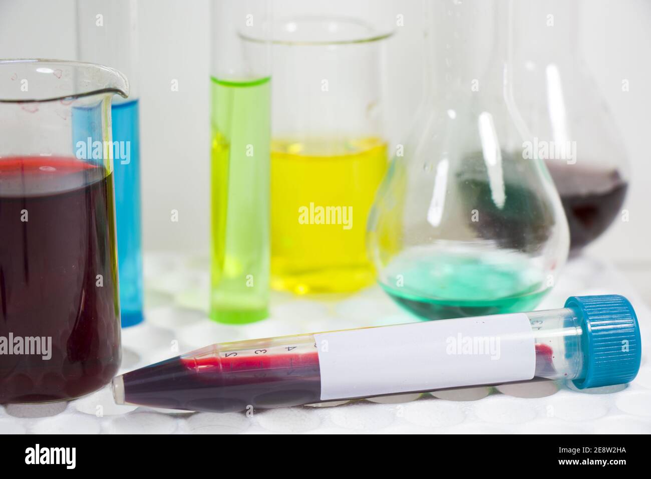 Closeup shot of healthcare containers and tubes filled with blood in ...
