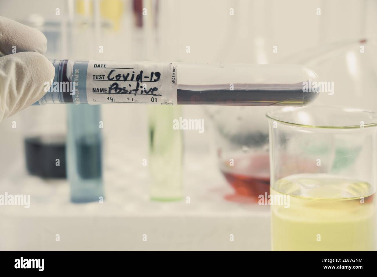Selective focus of a plastic tube filled with blood for covid 19 in the ...