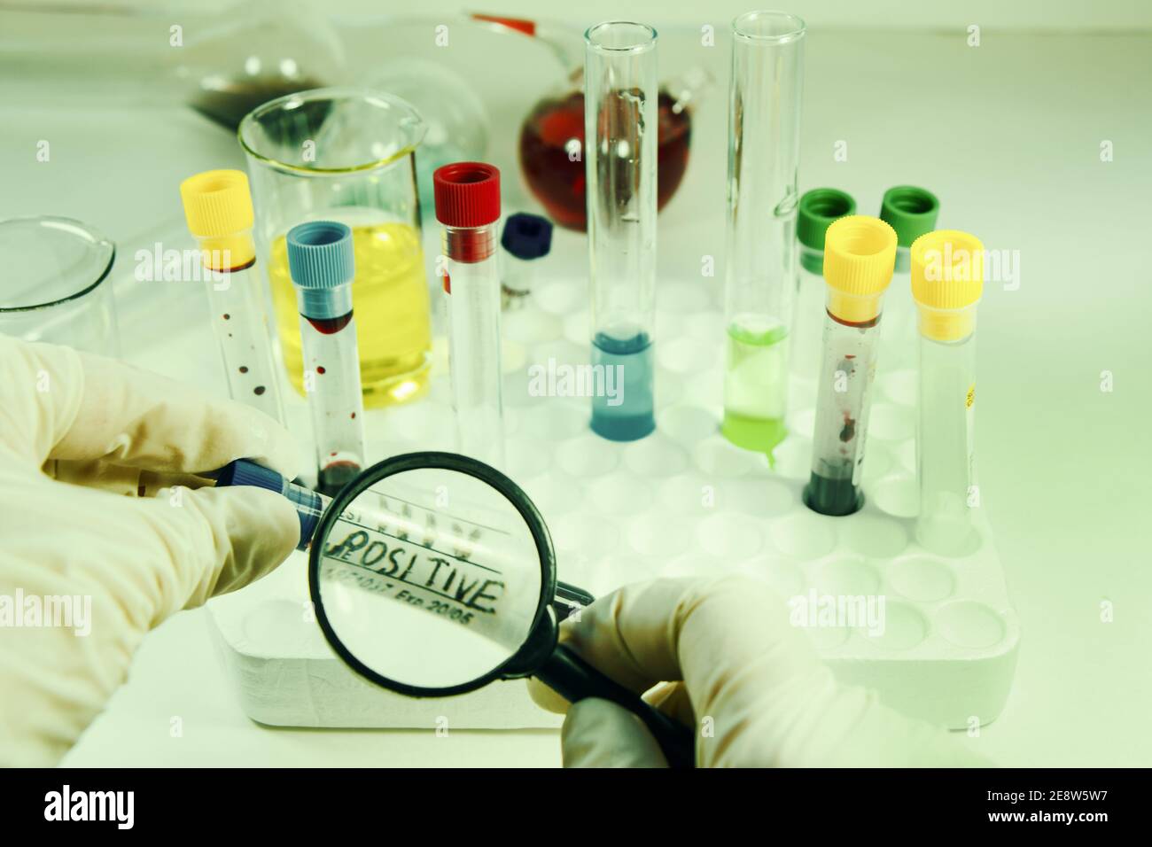 Biology under magnifying glass hi-res stock photography and images - Alamy